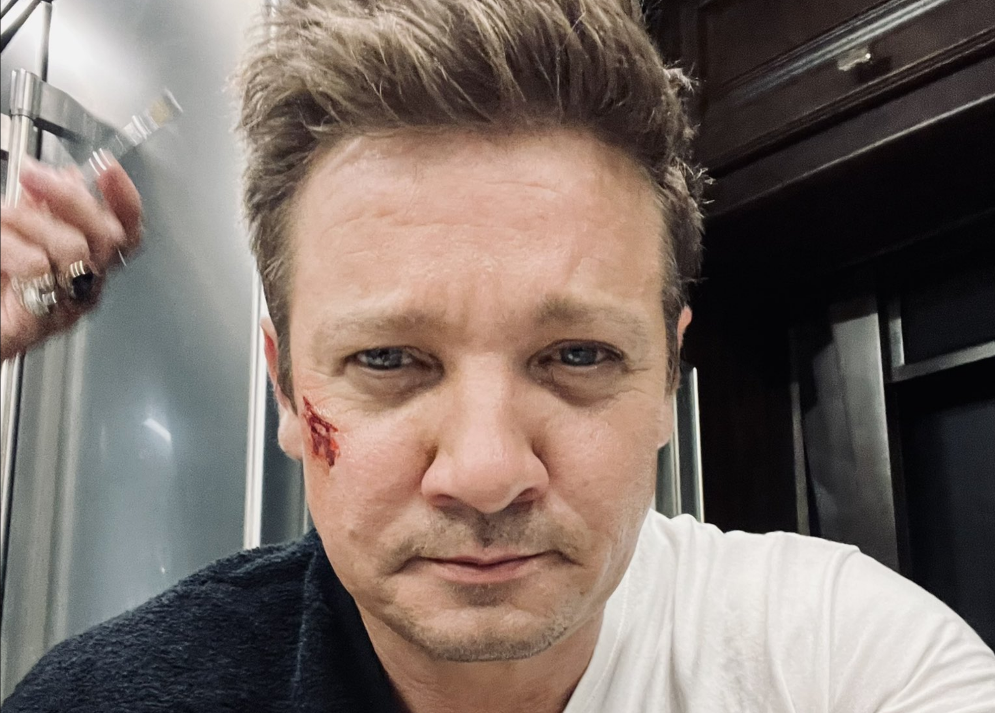 Jeremy Renner en estado crítico pero estable tras accidente mientras ...